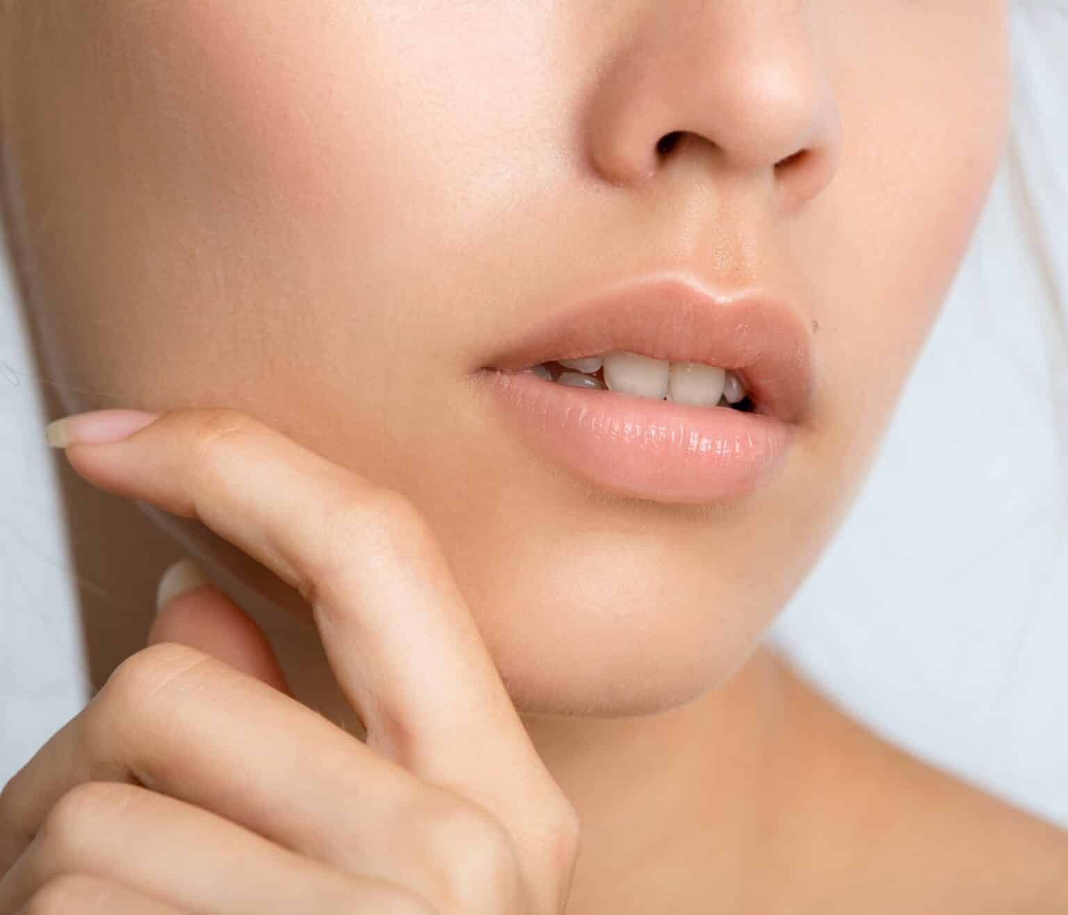 Lifting de la lèvre supérieure | Chirurgie Esthétique | Face Clinic Genève